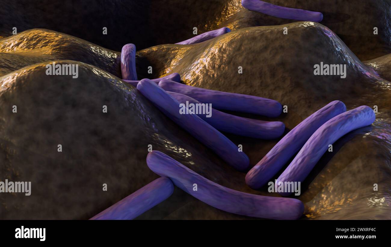 Hansens bacillus immagini e fotografie stock ad alta risoluzione - Alamy