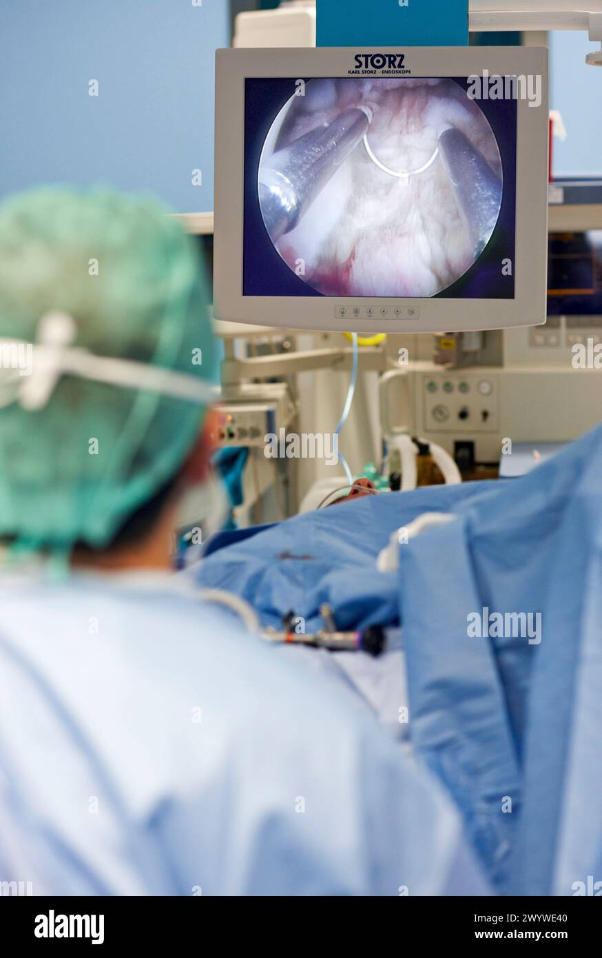 Resezione transuretrale della prostata immagini e fotografie stock ad ...