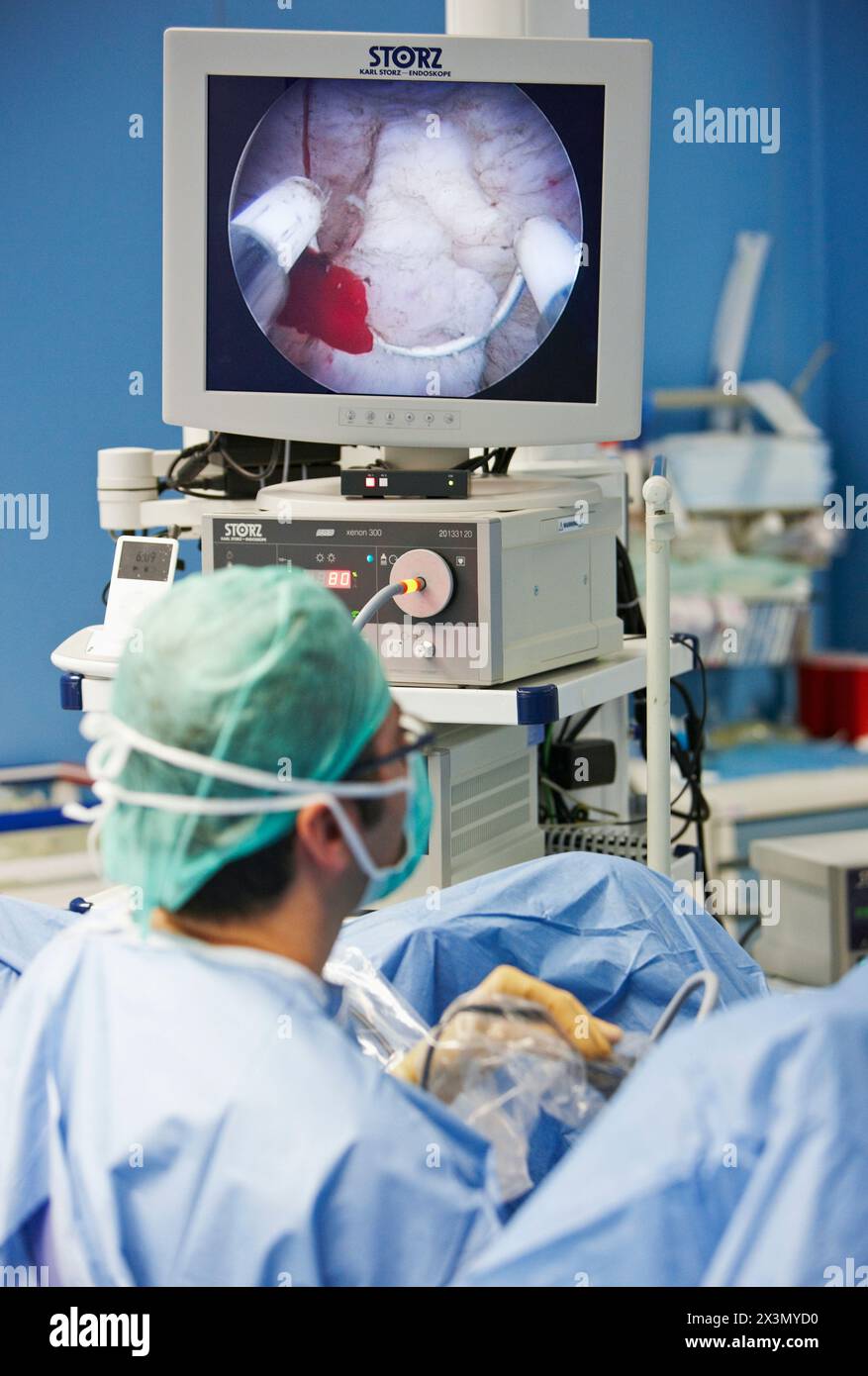 Resezione transuretrale della prostata immagini e fotografie stock ad ...