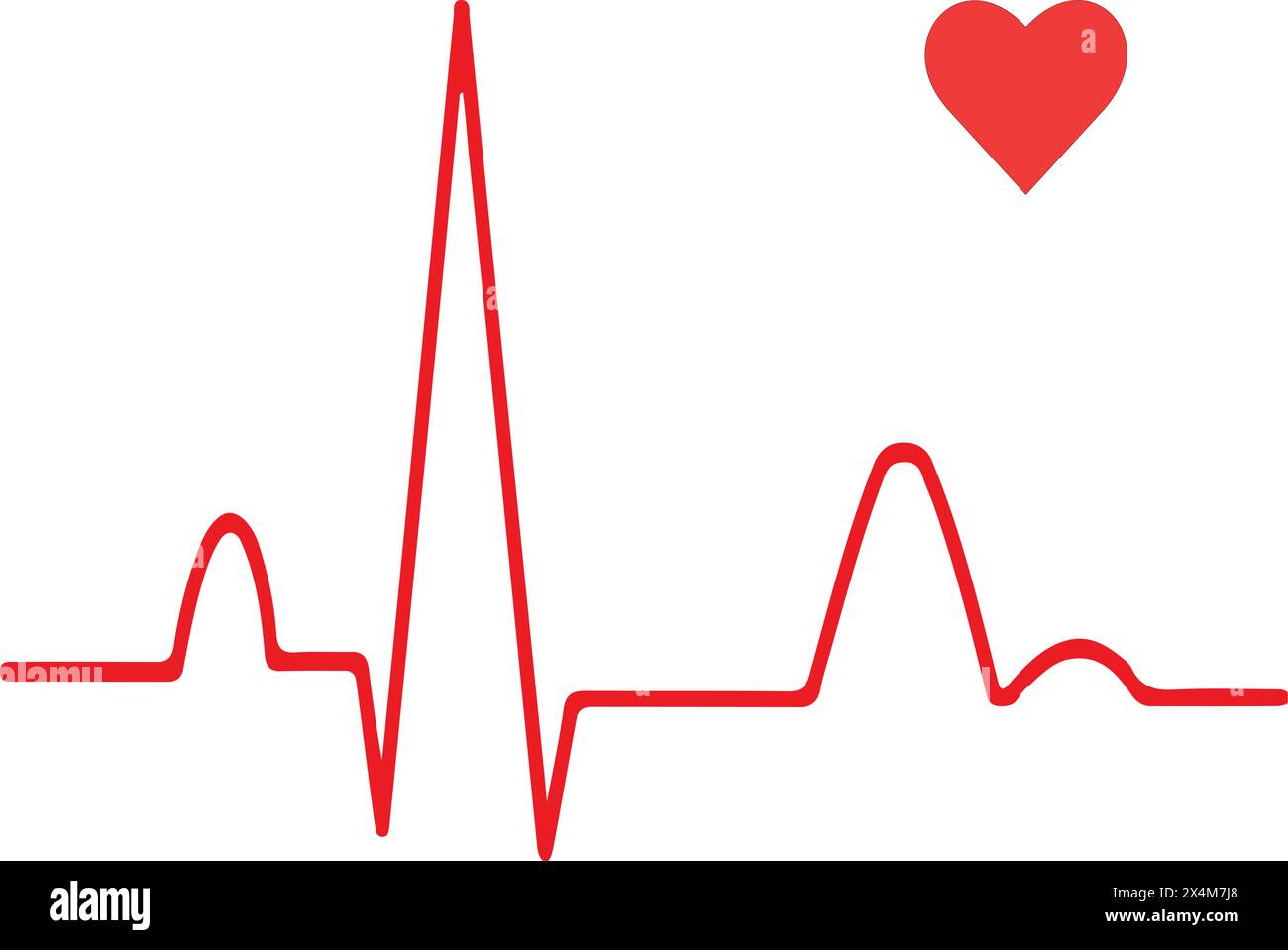 ECG (elettrocardiogramma) impulso cardiaco registrato su carta con ...