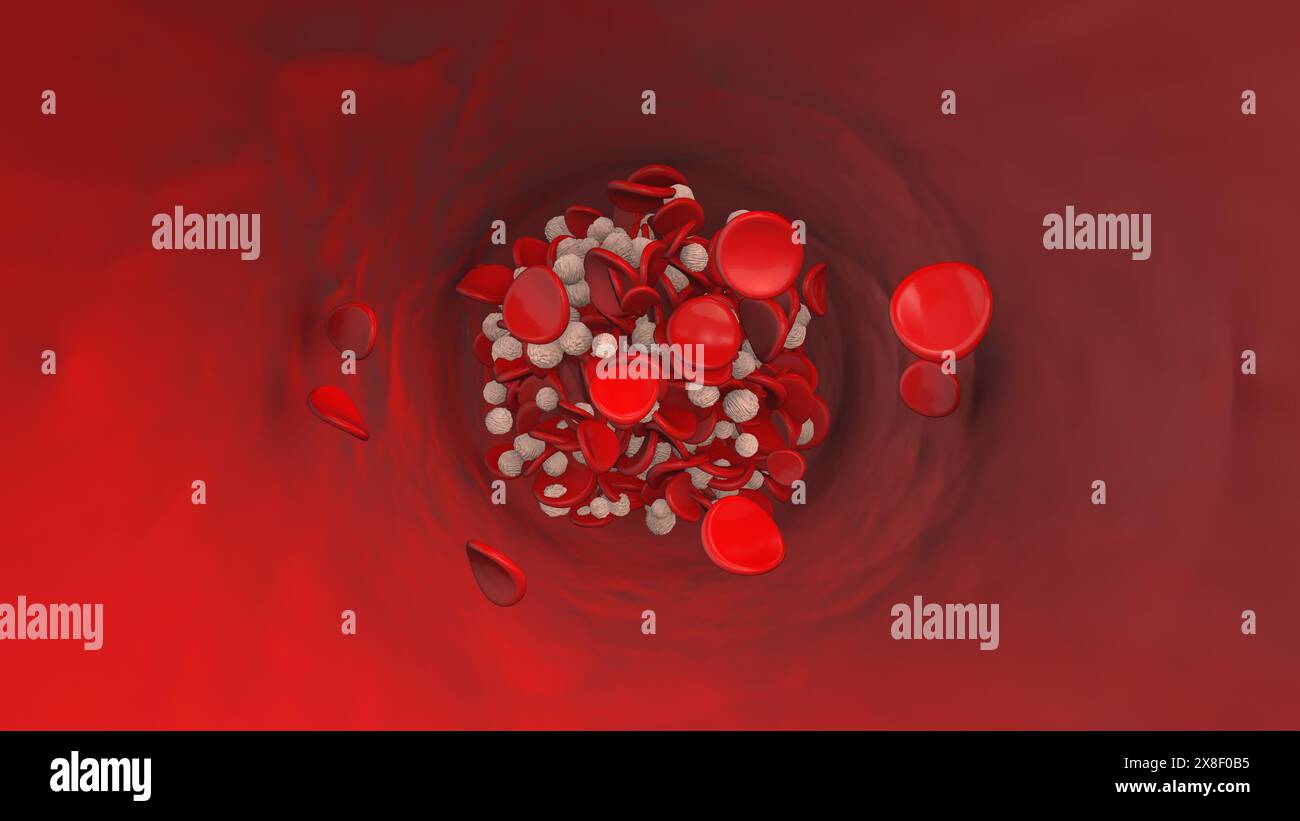 Coagulo di sangue umano immagini e fotografie stock ad alta risoluzione ...