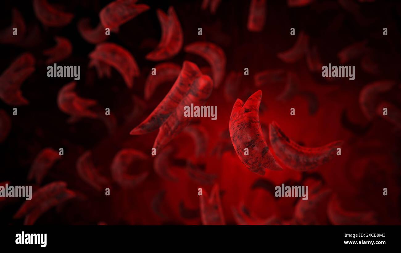 Malattia da deficienza immagini e fotografie stock ad alta risoluzione - Alamy