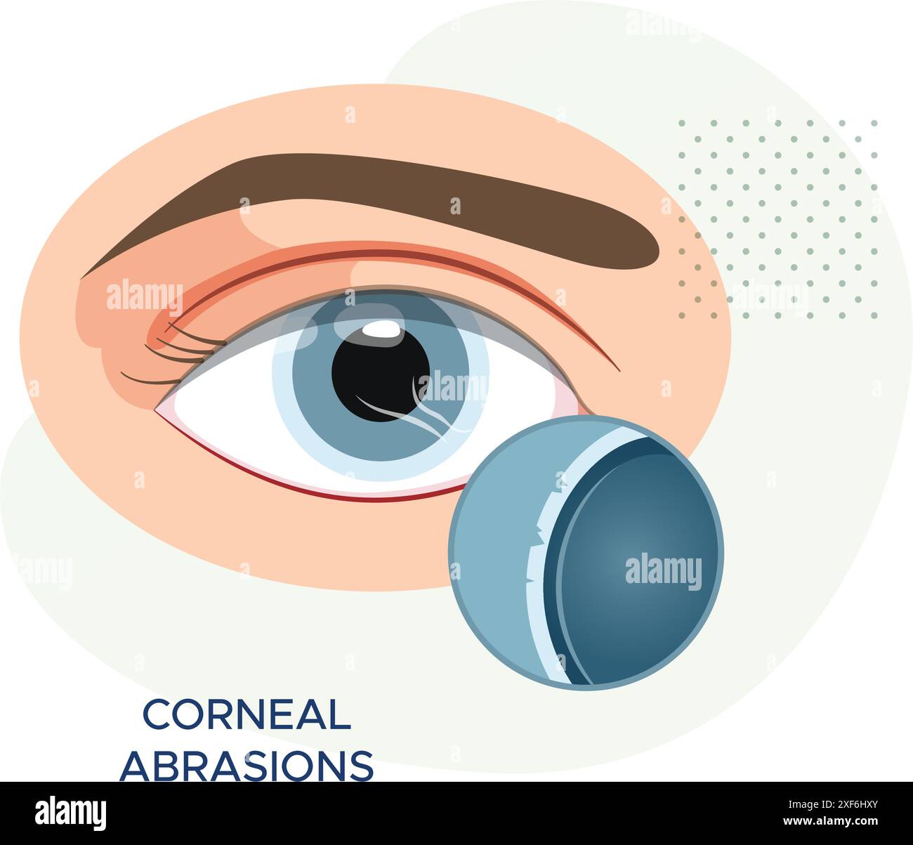 Esame diagnostico della cornea Immagini Vettoriali Stock - Alamy