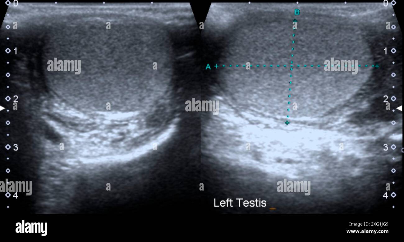 Testicoli uomo immagini e fotografie stock ad alta risoluzione - Alamy