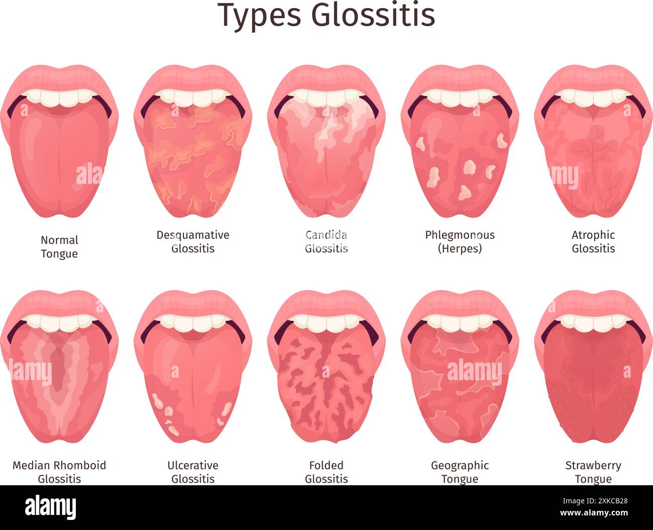 Types of bacteria disease immagini e fotografie stock ad alta ...