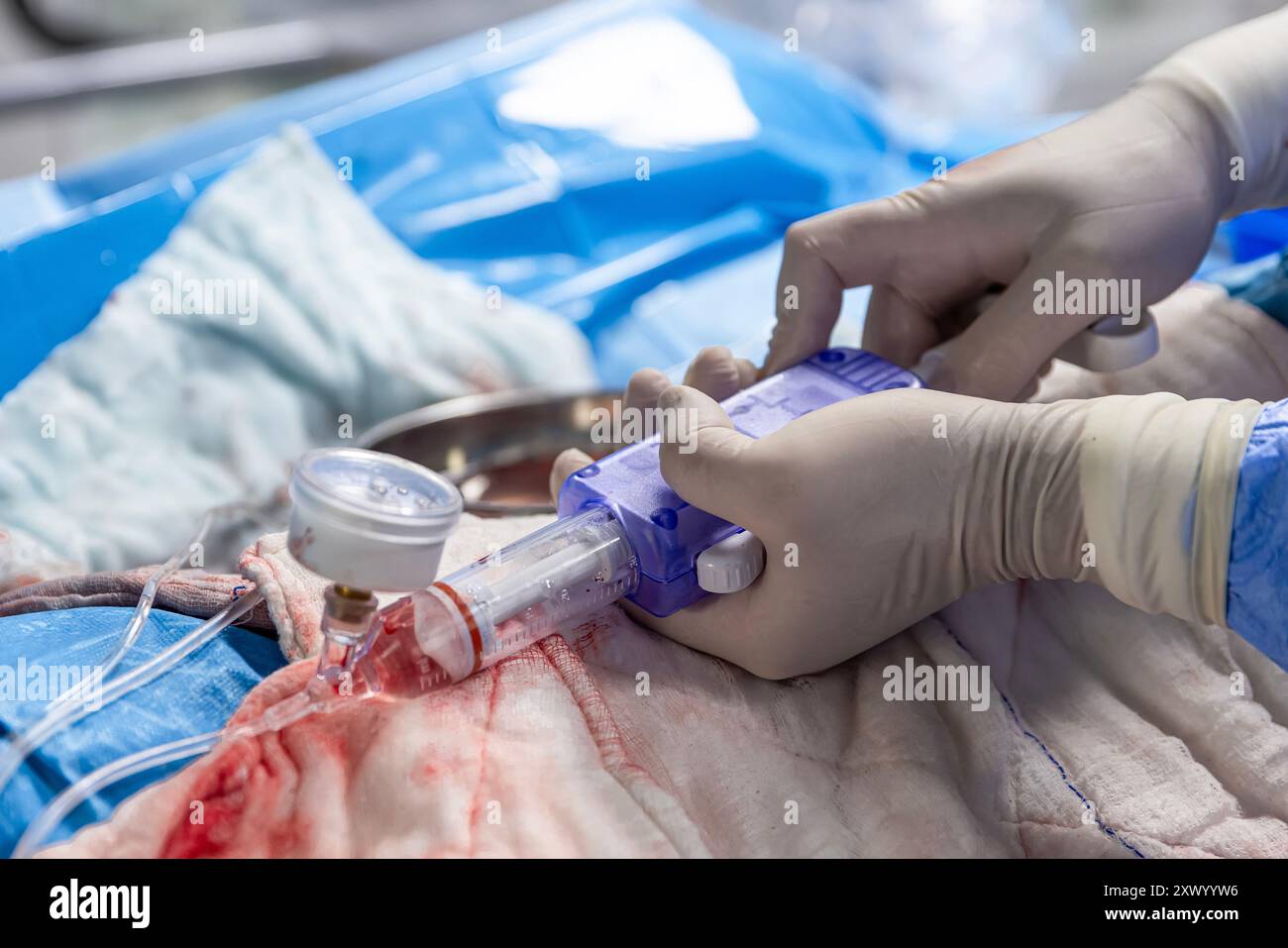 Procedura di posizionamento dello stent cardiaco in sala operatoria ...