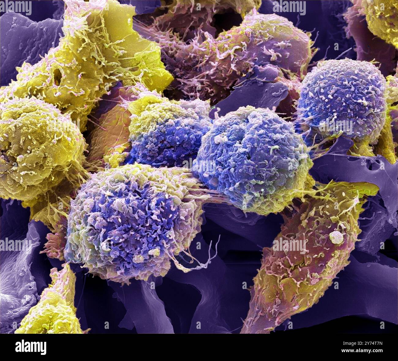 Hela cells immagini e fotografie stock ad alta risoluzione - Alamy