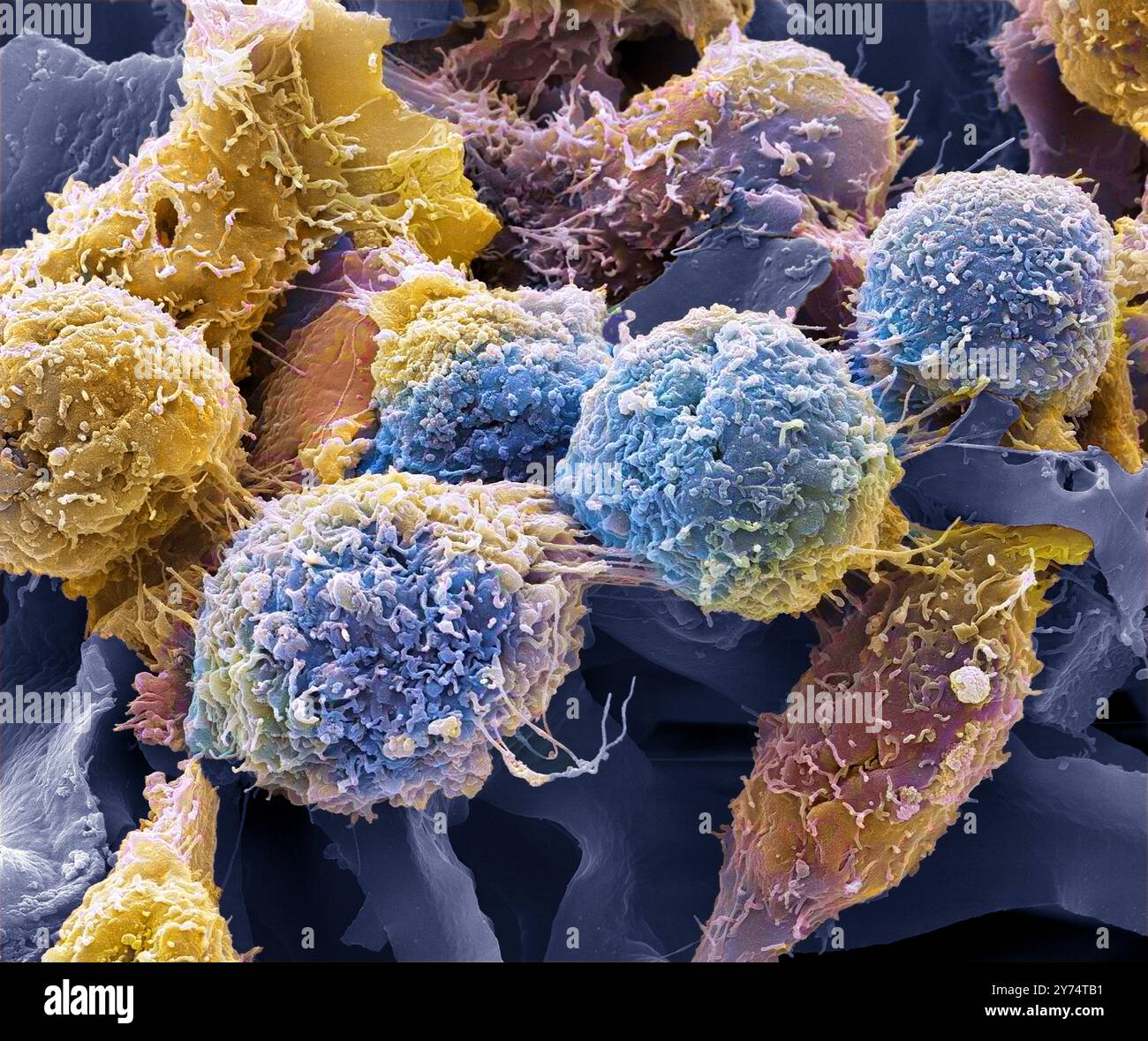 Hela cells immagini e fotografie stock ad alta risoluzione - Alamy