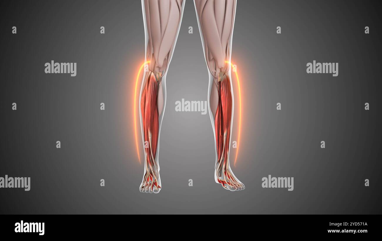 Infiammazione dei muscoli immagini e fotografie stock ad alta ...