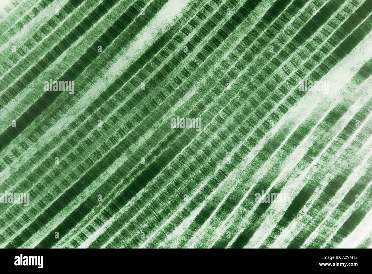 Collagene microscopio elettronico immagini e fotografie stock ad alta risoluzione - Alamy