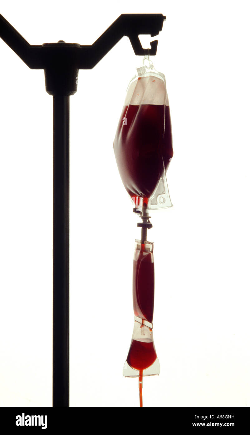 Blood iv drip transfusion immagini e fotografie stock ad alta ...