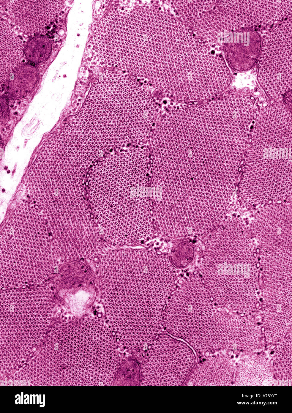 Muscolo scheletrico striato immagini e fotografie stock ad alta ...