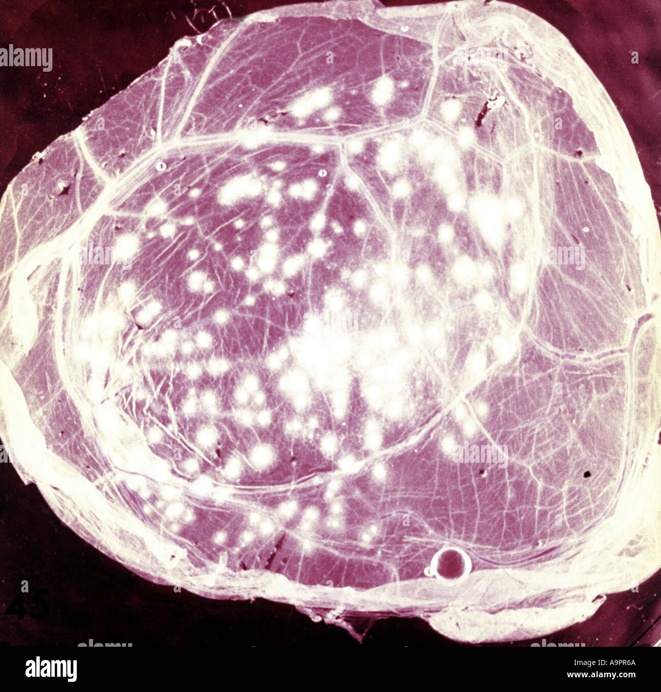 Smallpox variola virus immagini e fotografie stock ad alta risoluzione ...