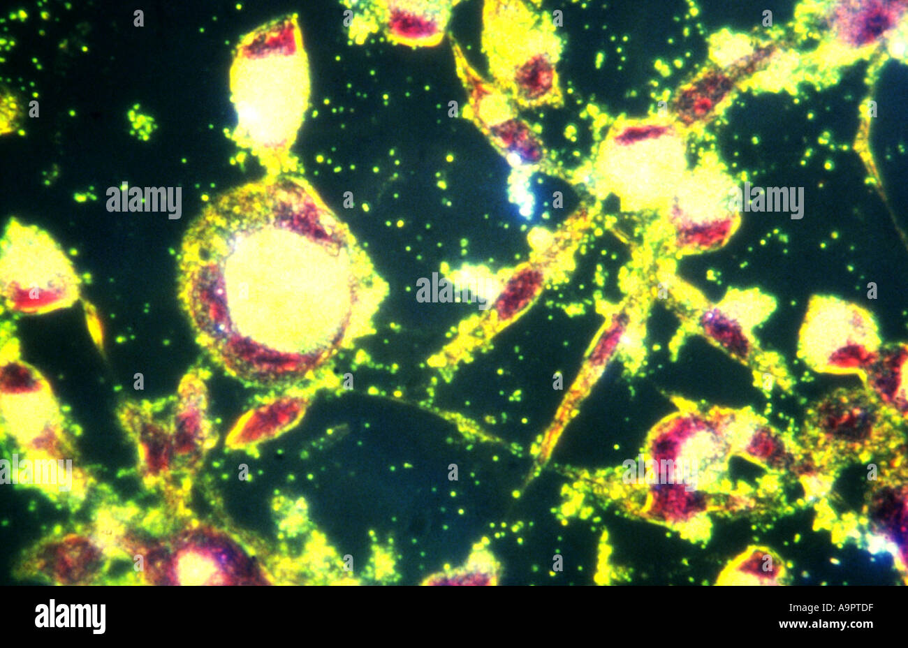 Chlamydia bacteria immagini e fotografie stock ad alta risoluzione - Alamy
