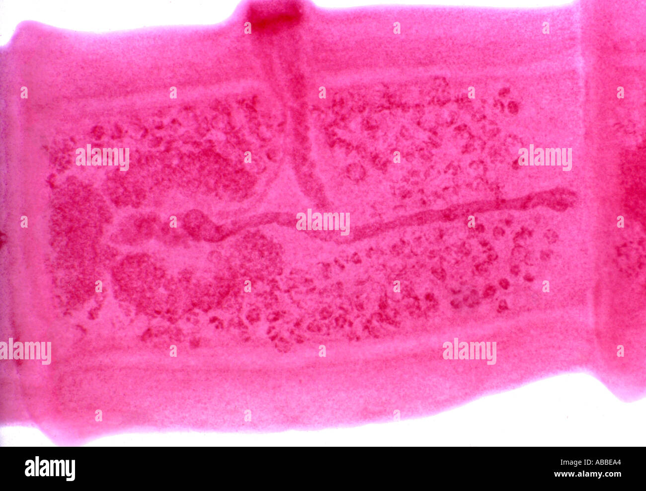 Tenia del cane immagini e fotografie stock ad alta risoluzione - Alamy