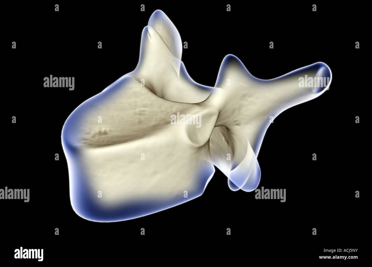 Processo spinoso delle ossa immagini e fotografie stock ad alta ...