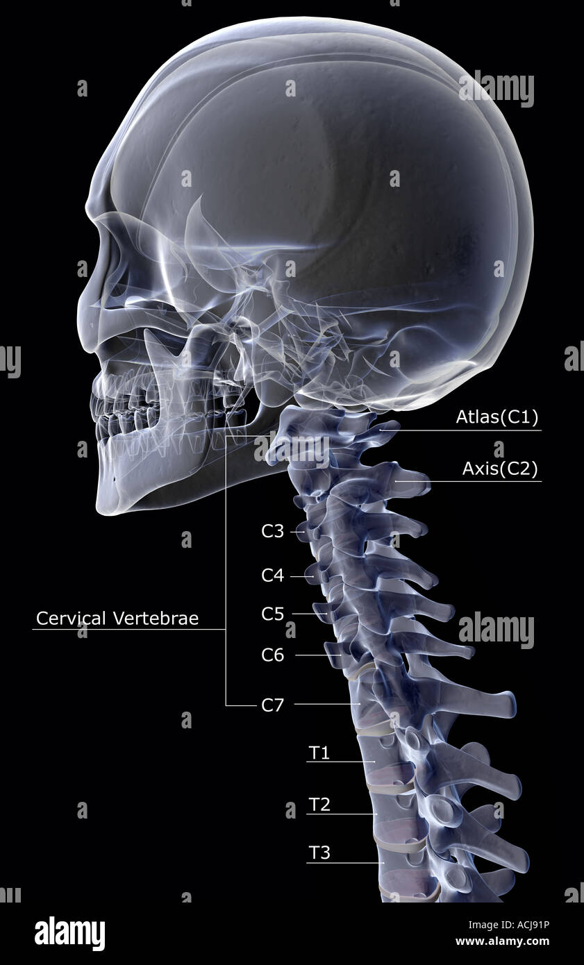 Radiografia del collo delle vertebre cervicali immagini e fotografie ...