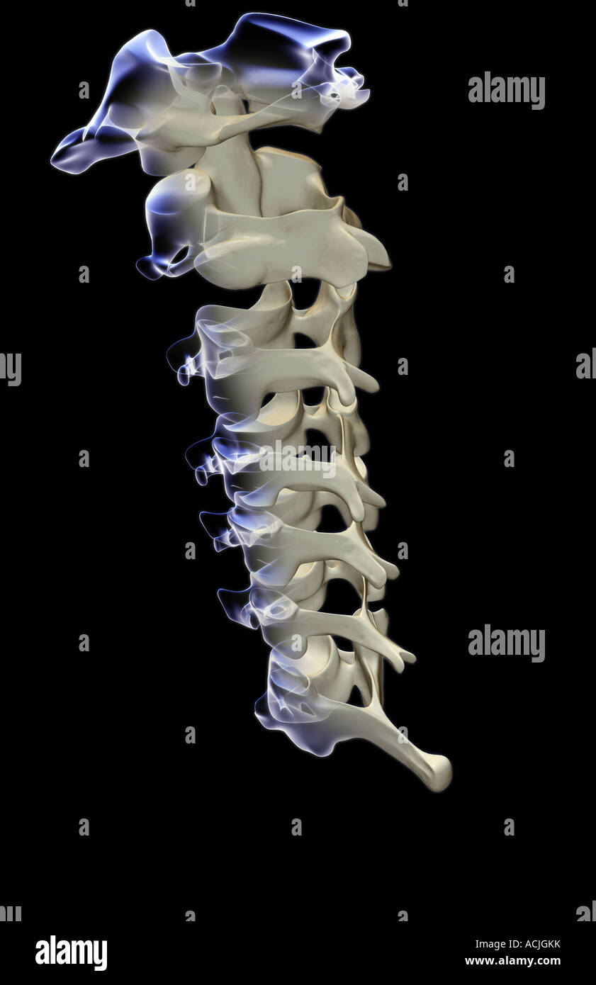 Radiografia Del Collo Delle Vertebre Cervicali Immagini e Fotos Stock ...