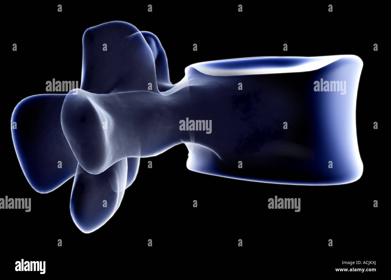 Lumbar vertebra x ray immagini e fotografie stock ad alta risoluzione ...
