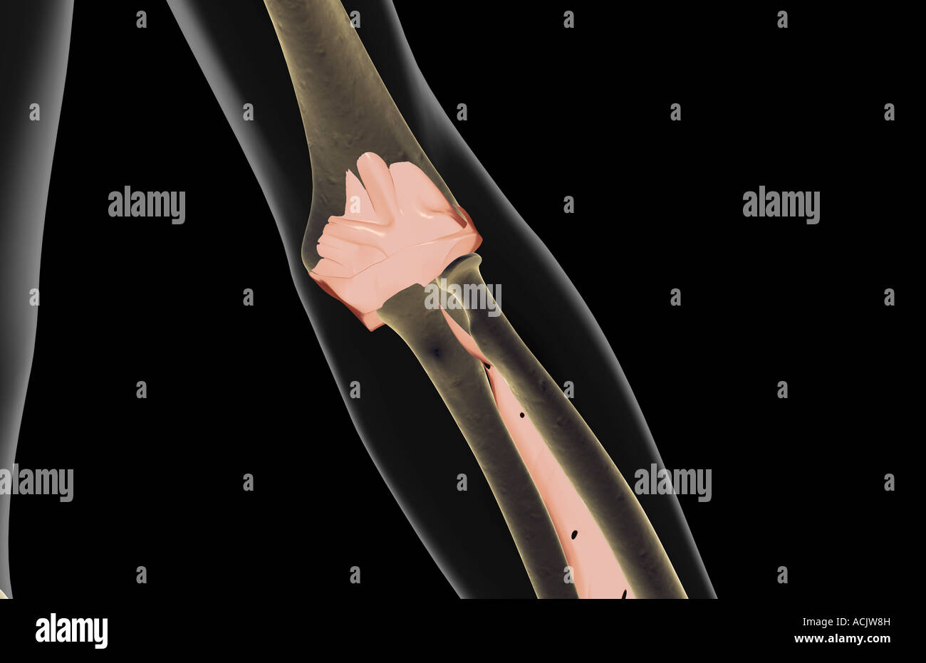 Legamenti anulari immagini e fotografie stock ad alta risoluzione - Alamy