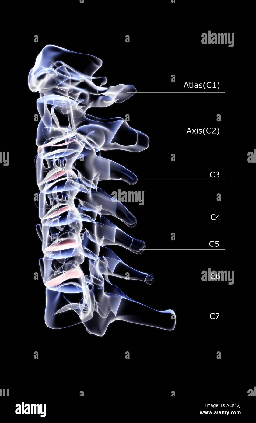 Radiografia del collo delle vertebre cervicali immagini e fotografie ...