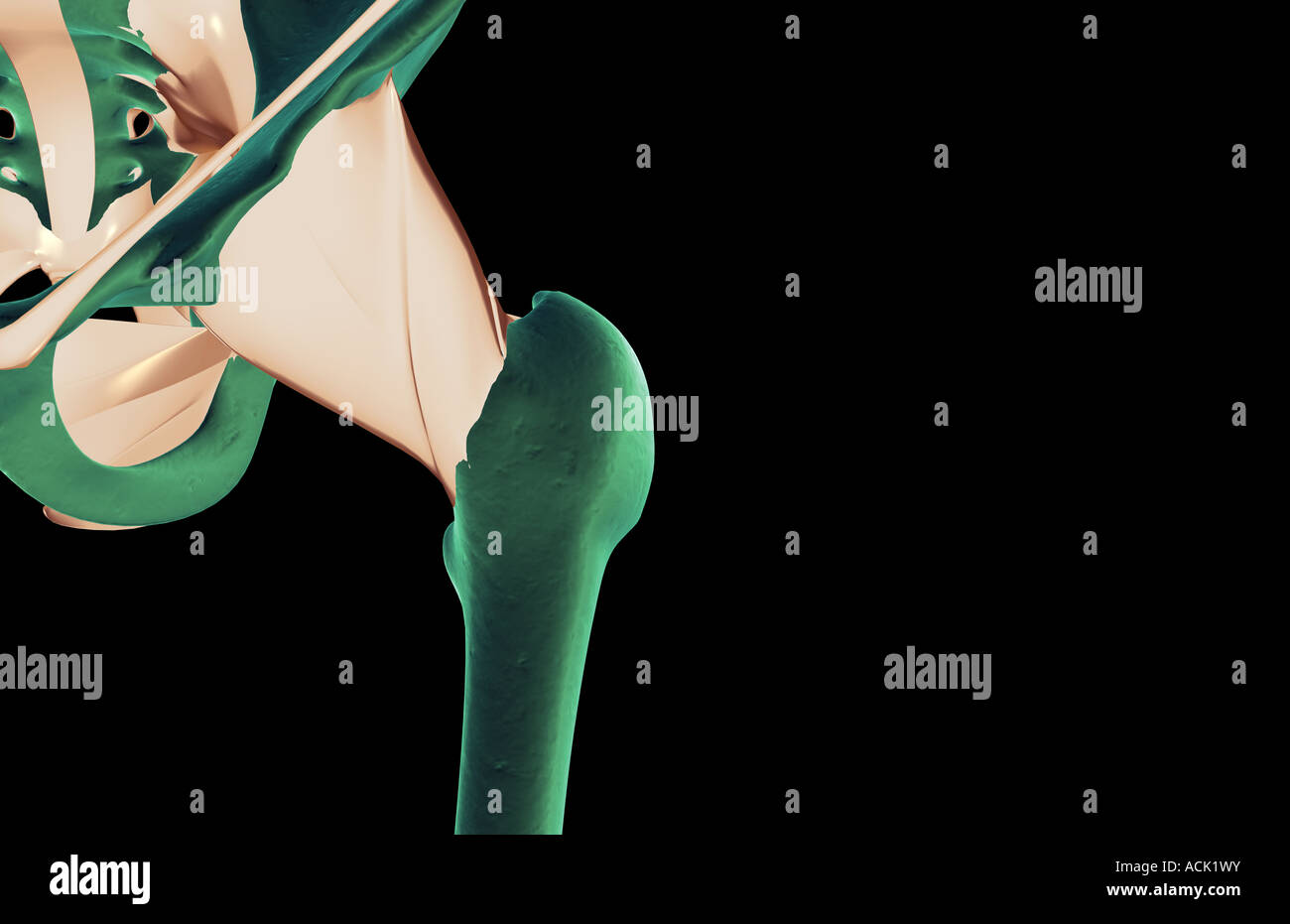 Legamento inguinale immagini e fotografie stock ad alta risoluzione - Alamy