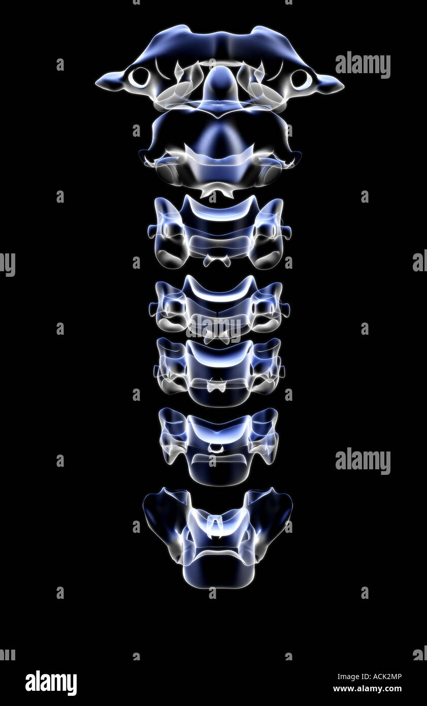 Radiografia Del Collo Delle Vertebre Cervicali Immagini e Fotos Stock ...