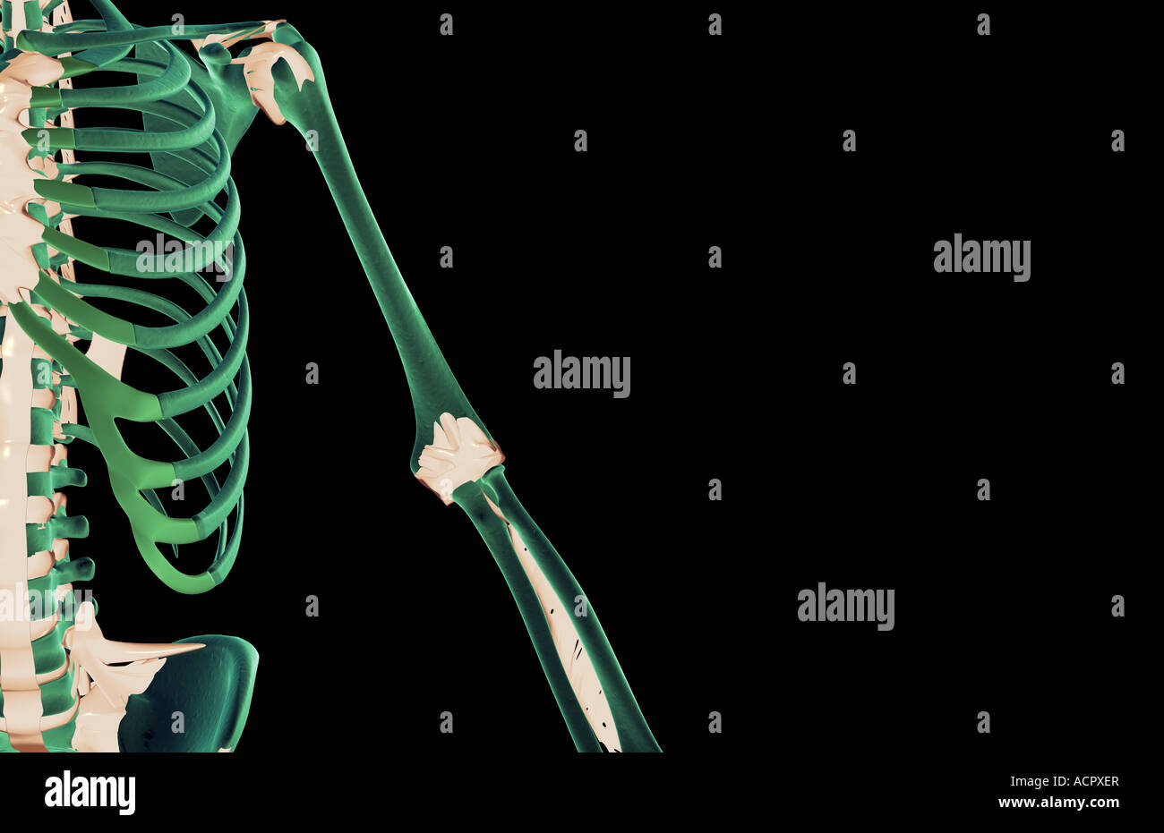 Legamenti capsulari immagini e fotografie stock ad alta risoluzione - Alamy