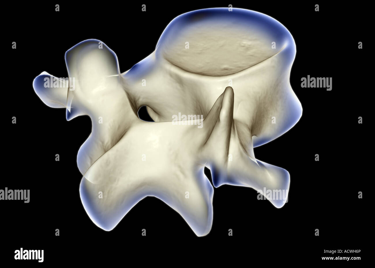 Lumbar vertebra x ray immagini e fotografie stock ad alta risoluzione ...