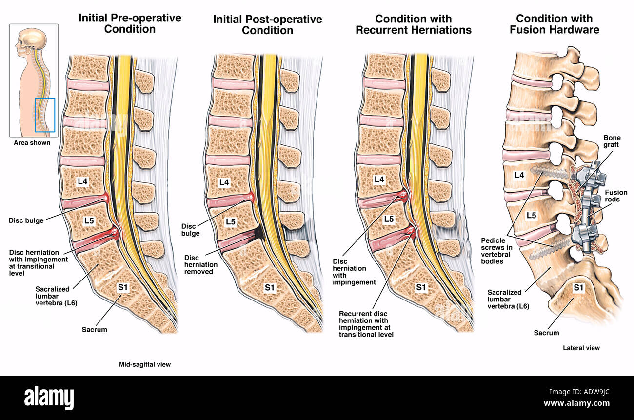 L5 s1 Immagini e Fotos Stock - Alamy