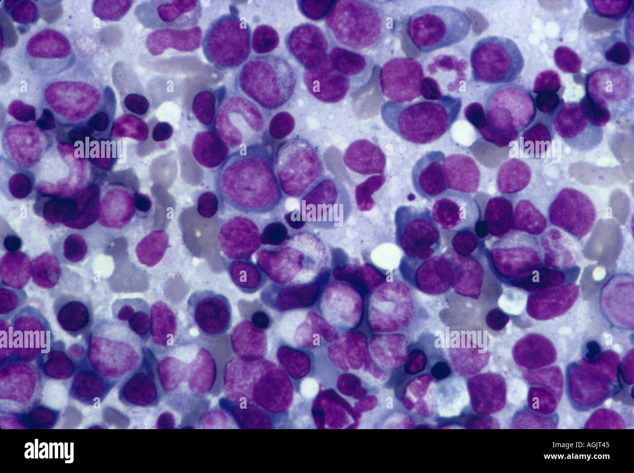 Striscio di sangue microscopico immagini e fotografie stock ad alta ...