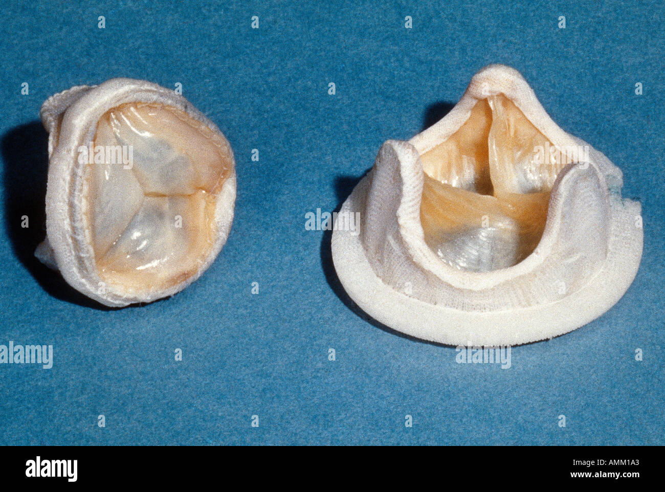 Protesi cardiaca protesica immagini e fotografie stock ad alta ...