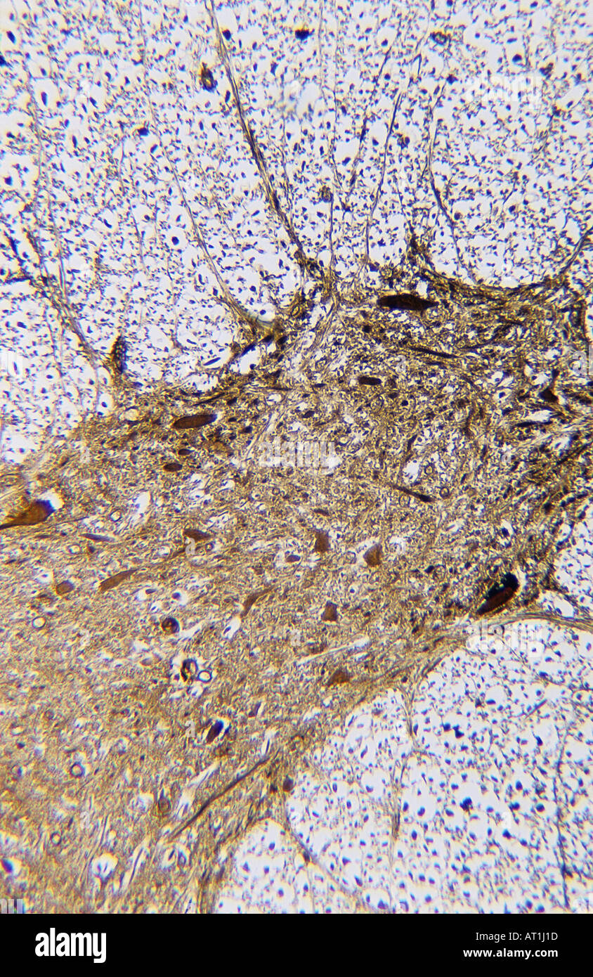 Midollo spinale microscopio immagini e fotografie stock ad alta ...