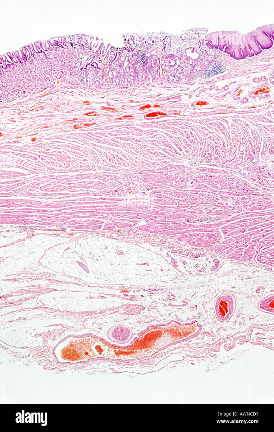 Esofago umano immagini e fotografie stock ad alta risoluzione - Alamy