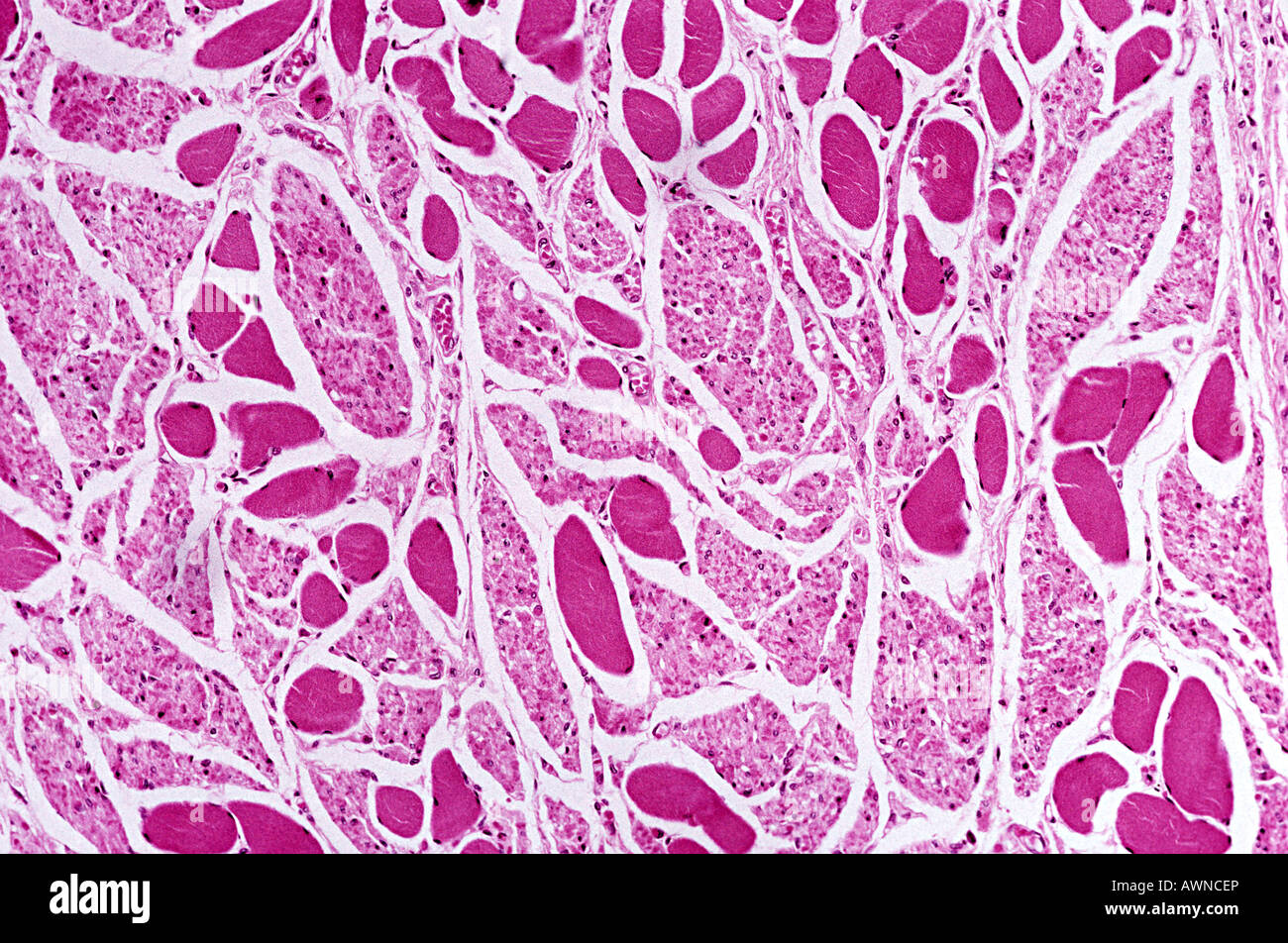 Esofago e apparato digerente immagini e fotografie stock ad alta ...