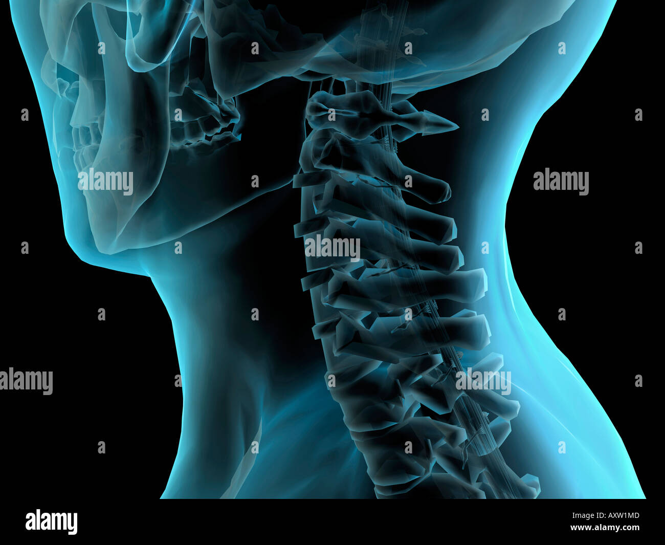 Primo piano dei raggi x della spina dorsale del collo immagini e ...