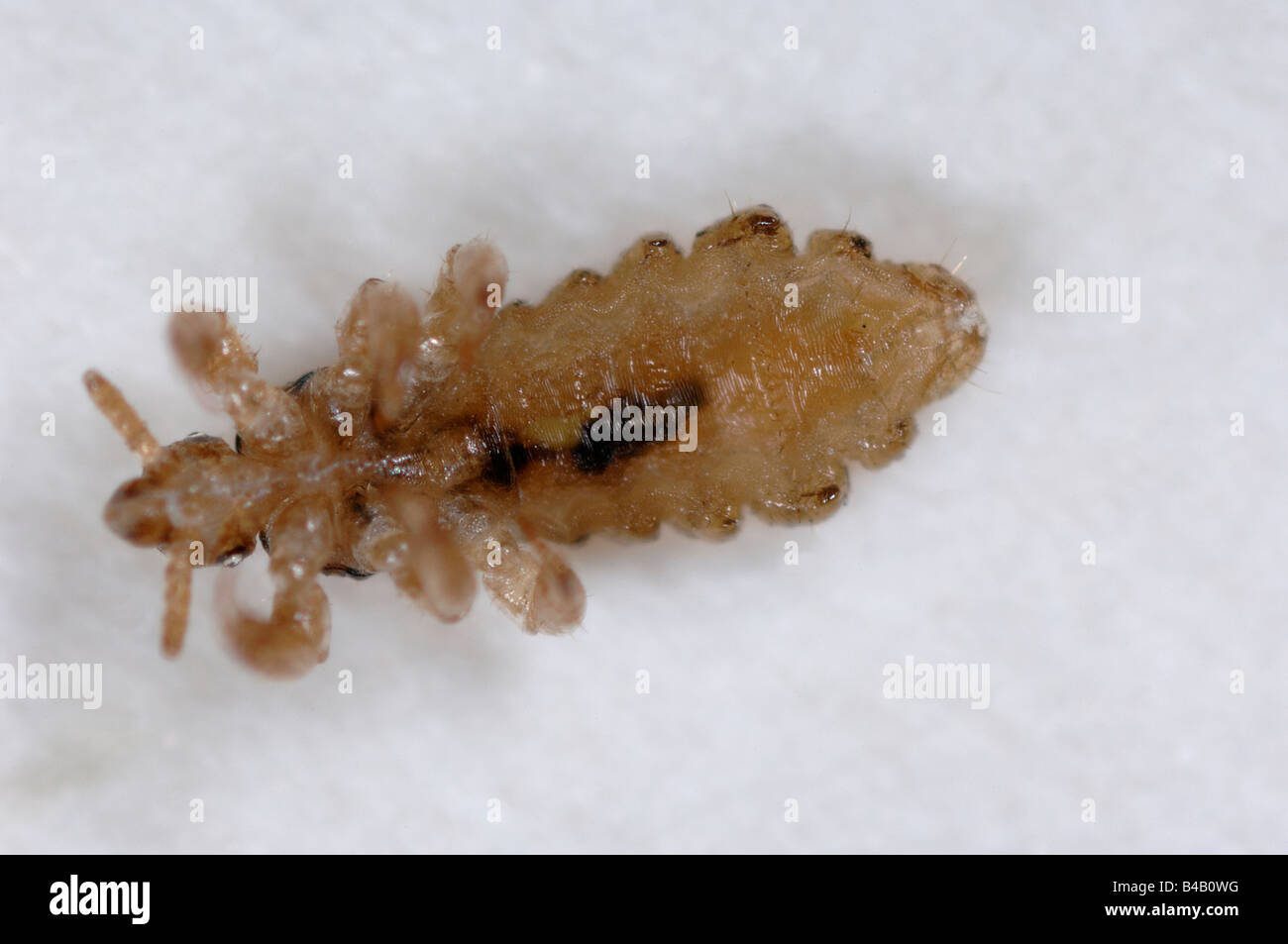 Pidocchio della testa umana immagini e fotografie stock ad alta ...