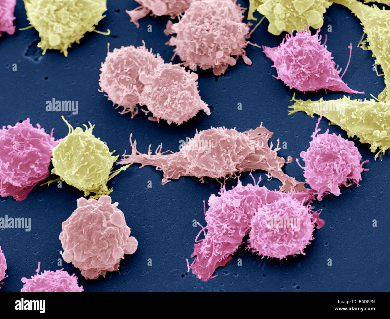 Electronmicrograph a scansione colorata immagini e fotografie stock ad ...