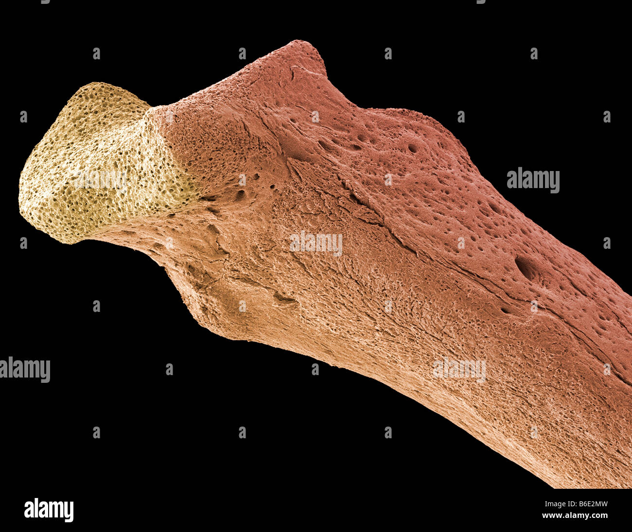 Osteoporosi sem immagini e fotografie stock ad alta risoluzione - Alamy