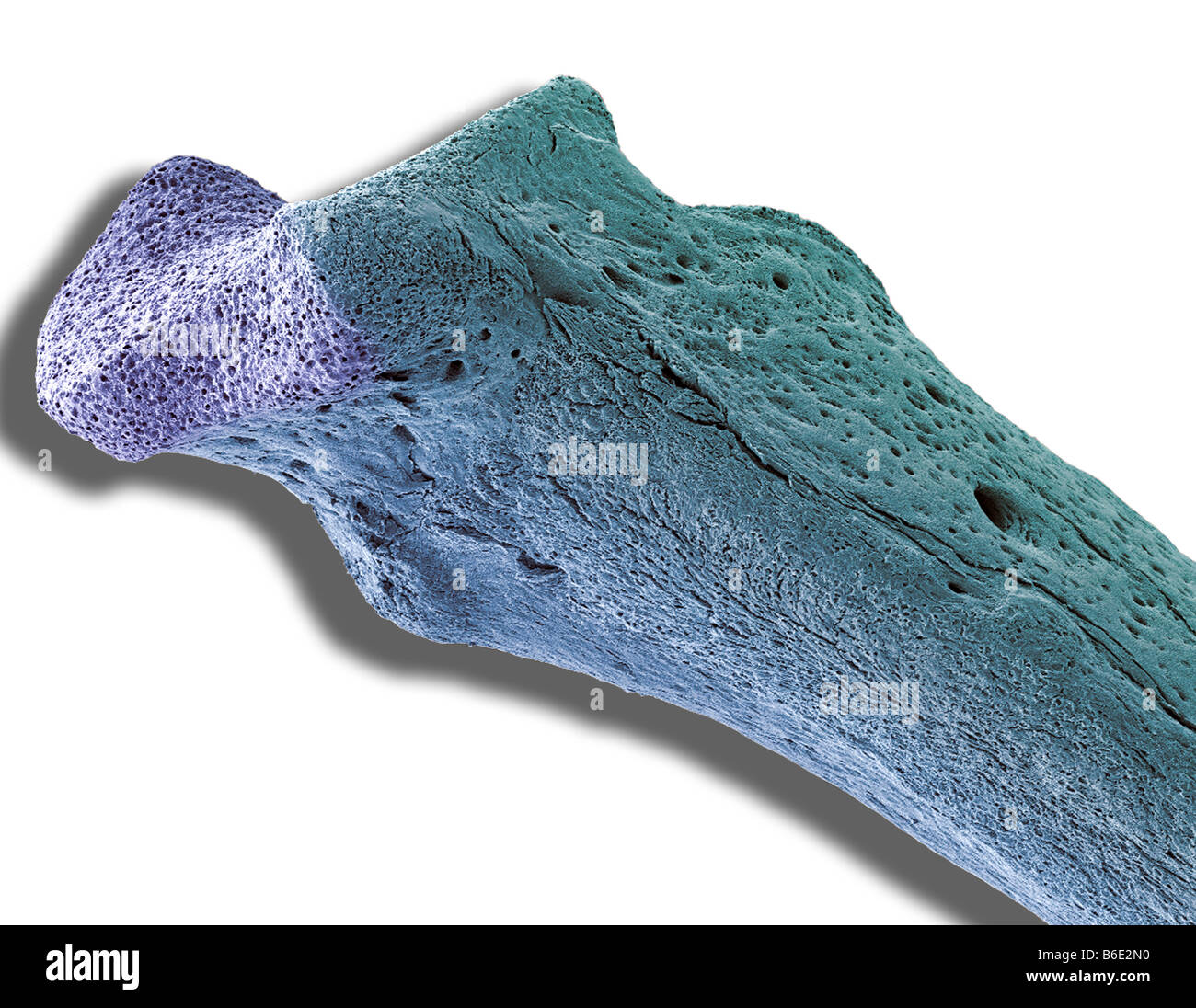 Electronmicrograph a scansione colorata immagini e fotografie stock ad ...