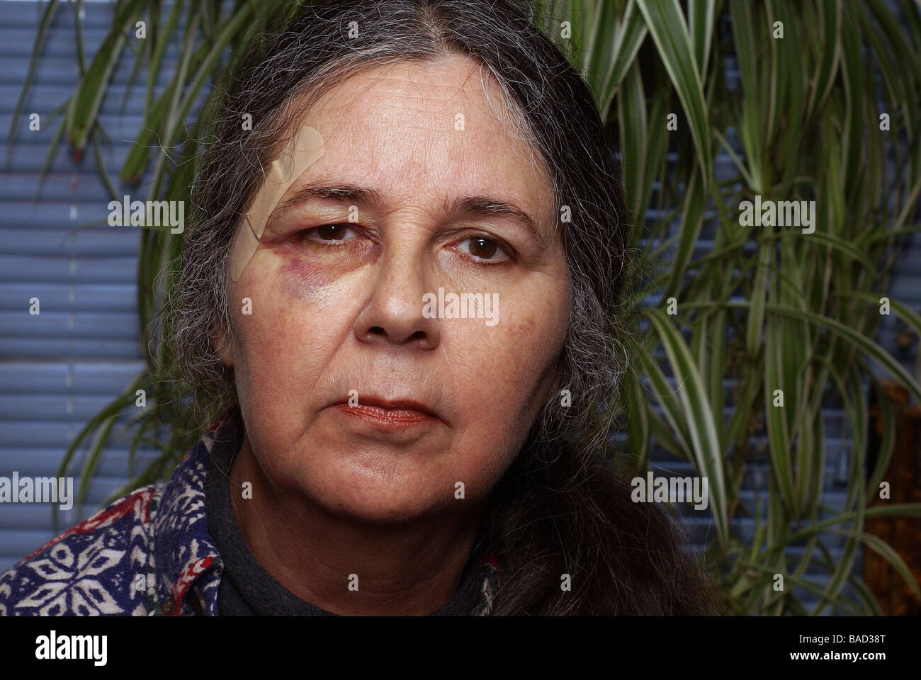 Ferita incline immagini e fotografie stock ad alta risoluzione - Alamy