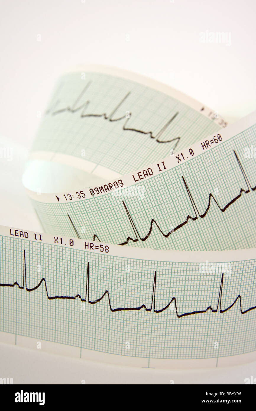 Ritmo cardiaco immagini e fotografie stock ad alta risoluzione - Alamy