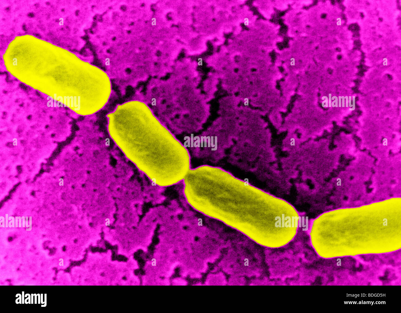 Clostridium bacteria immagini e fotografie stock ad alta risoluzione ...