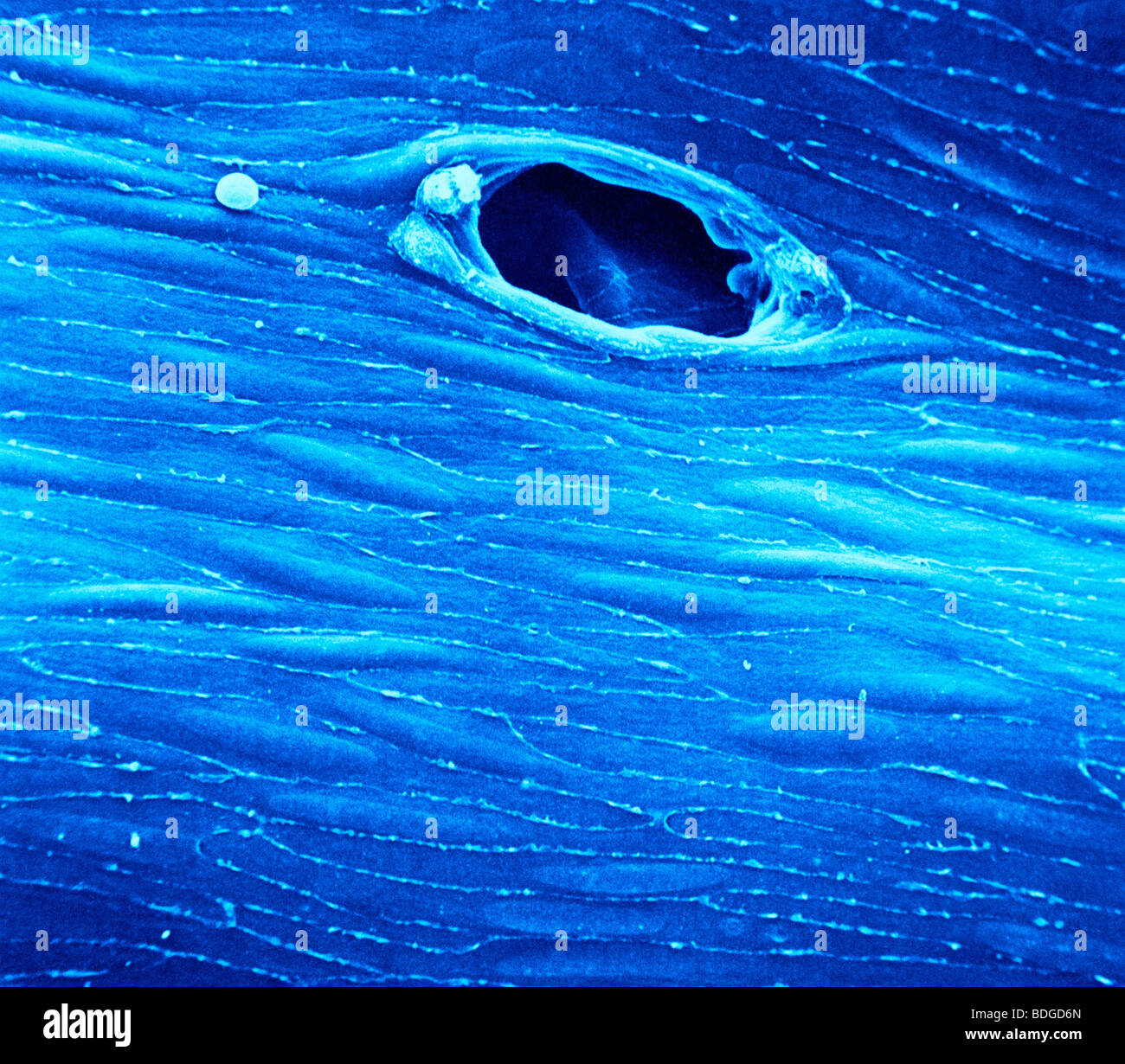 Endotelio Vascolare Immagini e Fotos Stock - Alamy