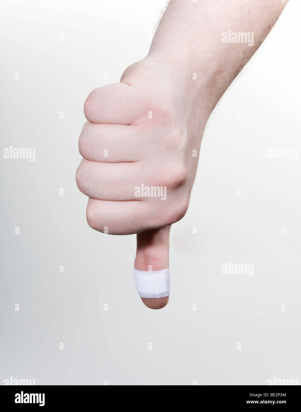 Lesioni del pollice immagini e fotografie stock ad alta risoluzione - Alamy