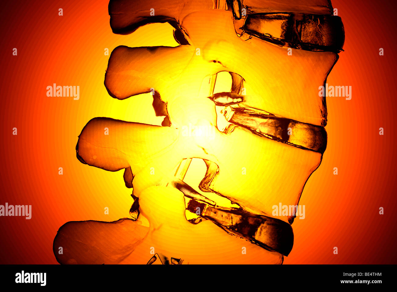 Vertebra della colonna vertebrale immagini e fotografie stock ad alta ...