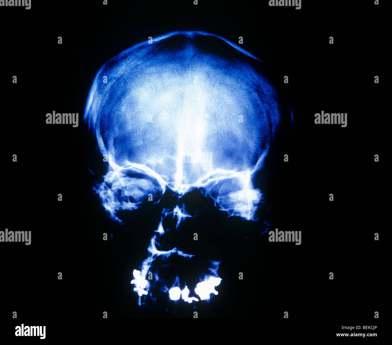 Teschio umano immagini e fotografie stock ad alta risoluzione - Alamy