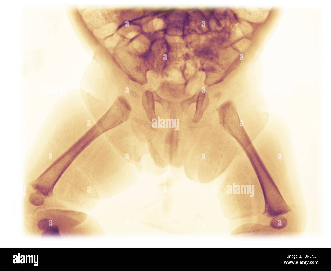 Anatomia del bacino immagini e fotografie stock ad alta risoluzione - Alamy