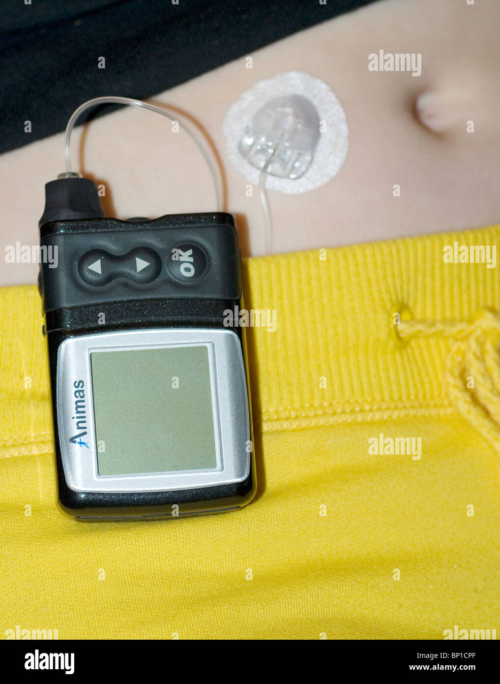 Pompa per insulina immagini e fotografie stock ad alta risoluzione - Alamy