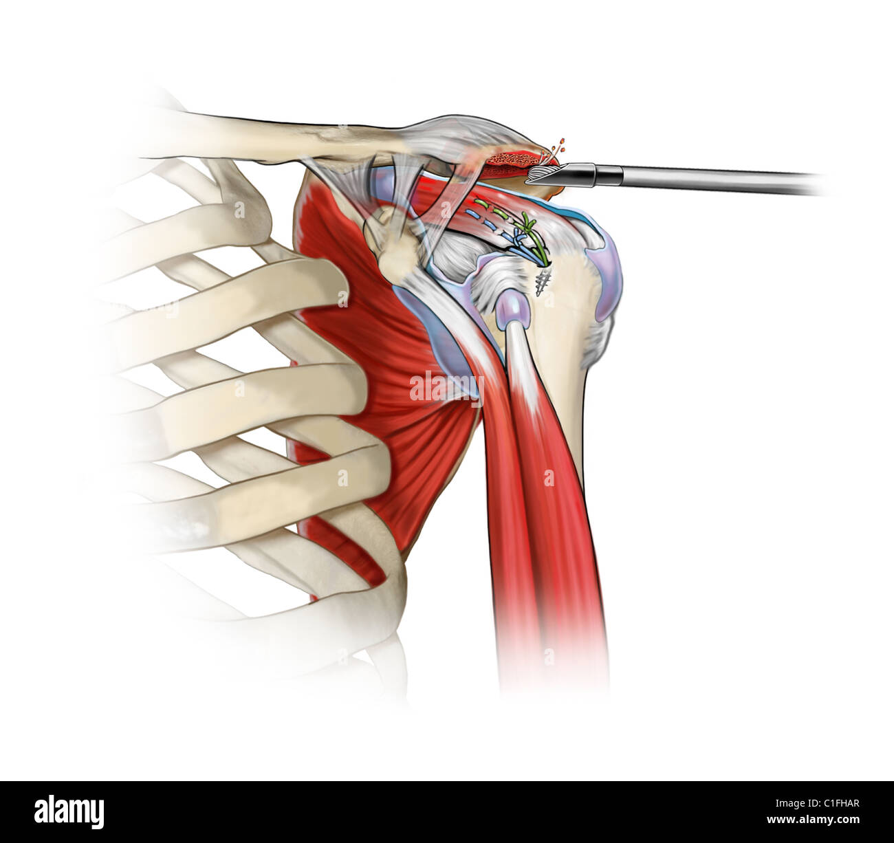 Cuffia dei rotatori immagini e fotografie stock ad alta risoluzione - Alamy